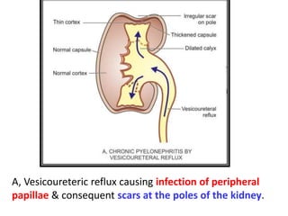 THE KIDNEY: TUBULAR & TUBULOINTERSTITIAL DISEASES | PPTX