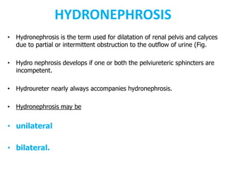 The Kidney: OBSTRUCTIVE UROPATHY | PPTX
