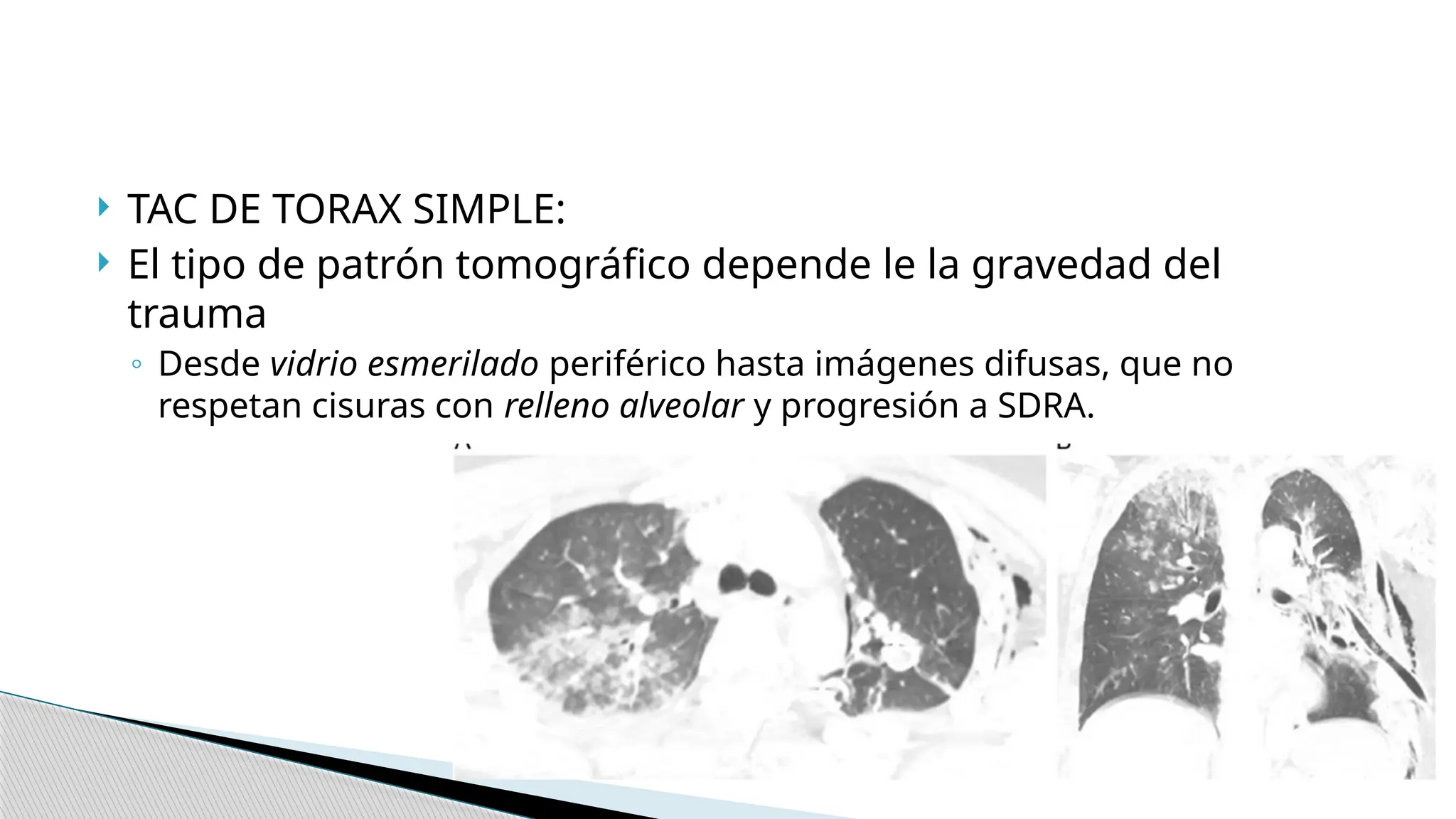 9 - Trauma de Tórax, ABCD y manejo del trauma.pptx