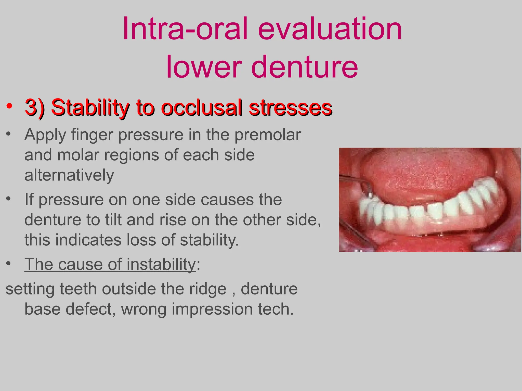 9-try in stage in complete denture..ppt