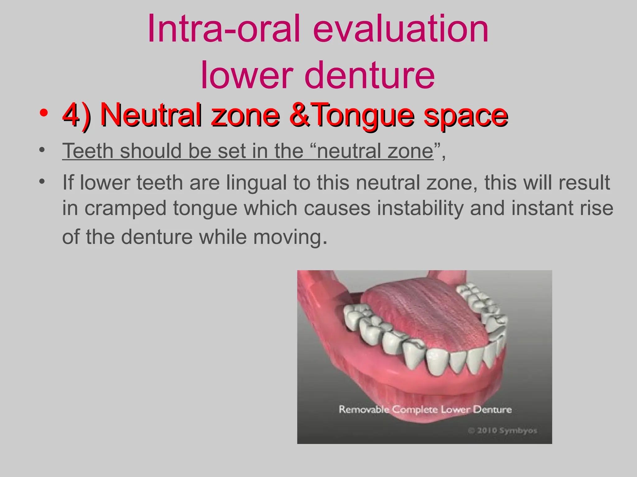 9-try in stage in complete denture..ppt