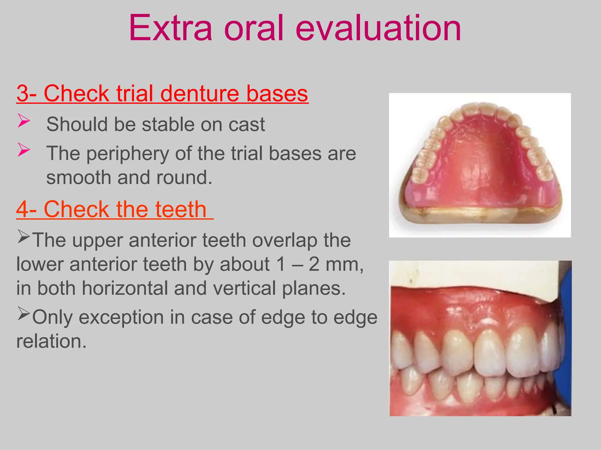 9-try in stage in complete denture..ppt