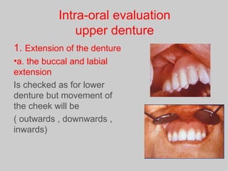 9-try in stage in complete denture..ppt