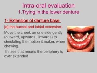 9-try in stage in complete denture..ppt