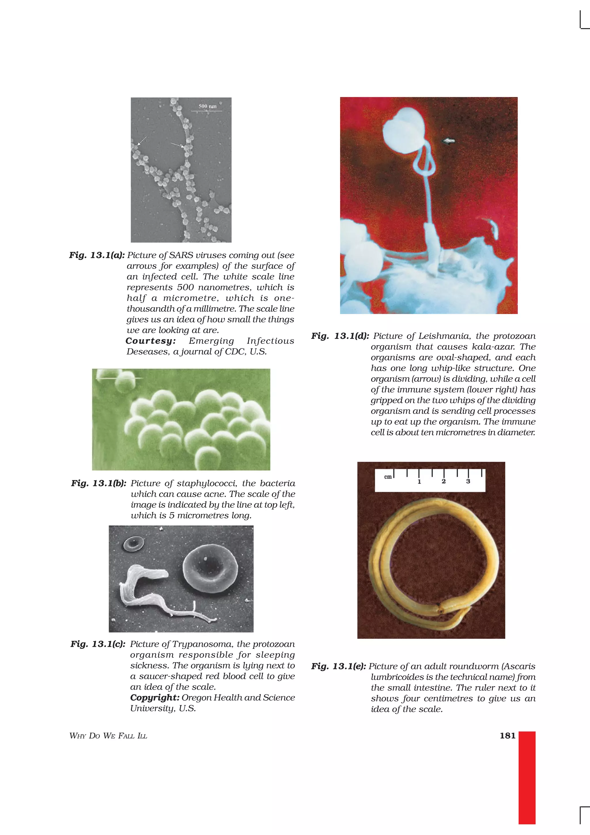 9 why do we fall ill | PDF | Infectious Diseases | Diseases and Conditions