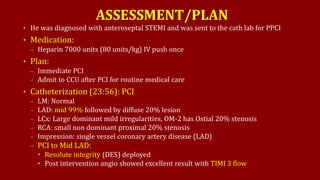 ST-Elevation Myocardial Infarction | PPTX