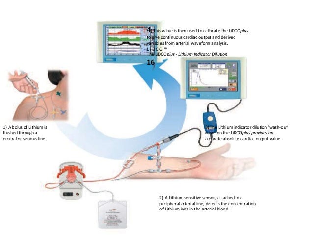 Haemodynamic monitoring-Minati