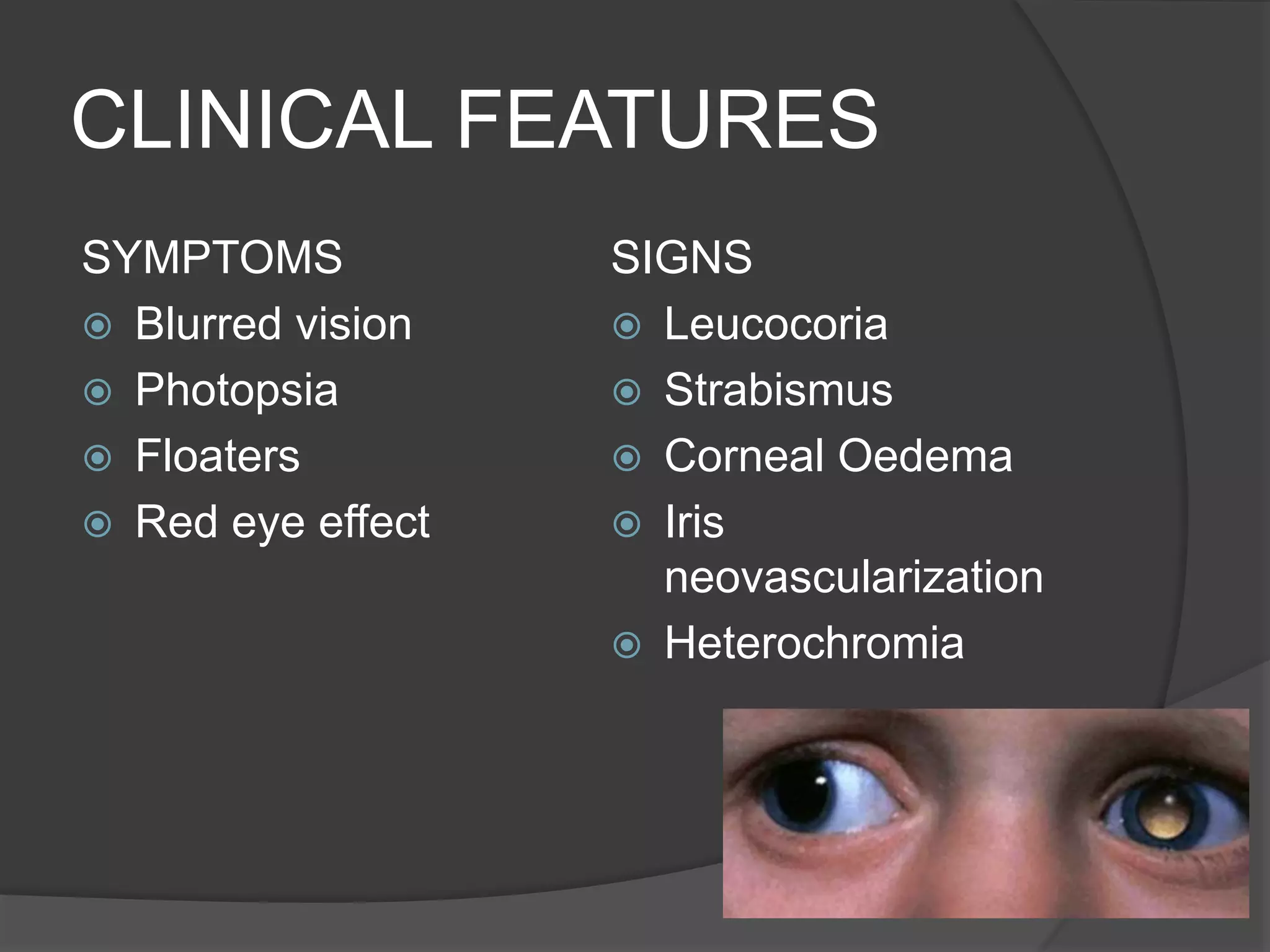 Coat’S Disease | PPTX