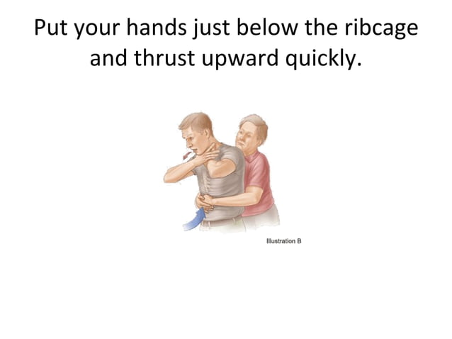 911 choking | PPT