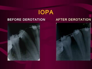 911 krishnan ppt | PPT