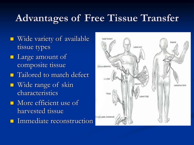 9162_free-flap-reconstruction-of-head-and-neck-defects.ppt