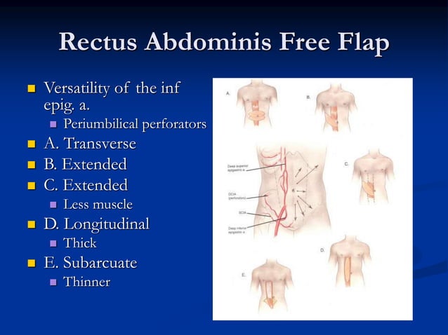 9162_free-flap-reconstruction-of-head-and-neck-defects.ppt