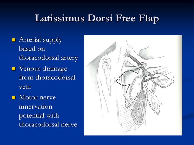9162_free-flap-reconstruction-of-head-and-neck-defects.ppt