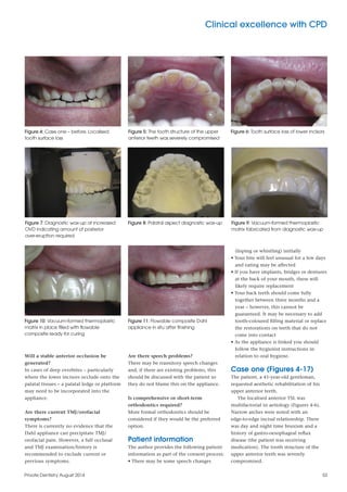 ToothSurfaceLoss_Part3 | PDF