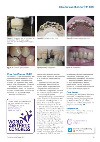 ToothSurfaceLoss_Part3 | PDF