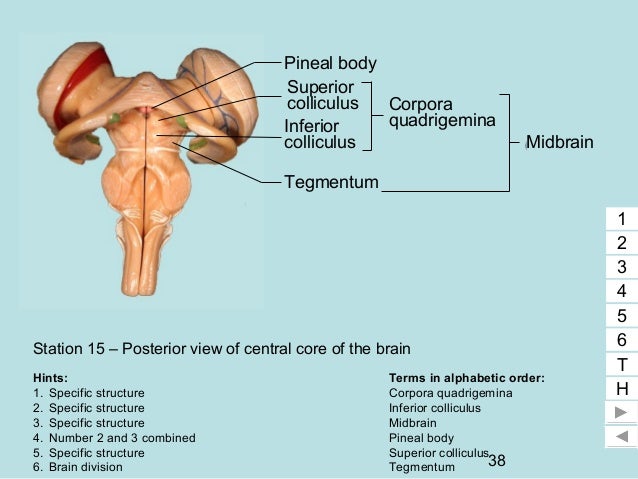 Dissectible Brain Model PowerPoint