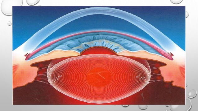 Physiology of lens and Cataractogenesis | PPTX | Eye and Vision ...