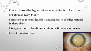 Physiology of lens and Cataractogenesis | PPTX