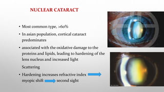 Physiology of lens and Cataractogenesis | PPTX