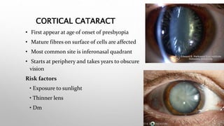 Physiology of lens and Cataractogenesis | PPTX