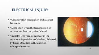 Physiology of lens and Cataractogenesis | PPTX