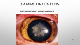 Physiology of lens and Cataractogenesis | PPTX