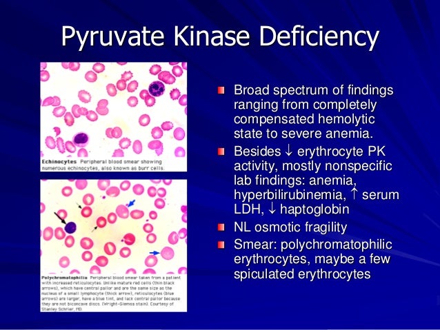 Heme Onc Team Sept 2004