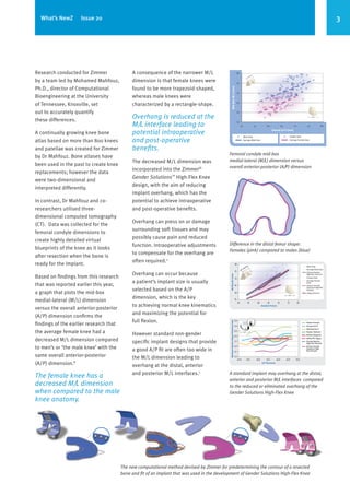 Zimmer - Gender Solutions | PDF | Bone and Joint Conditions | Diseases ...