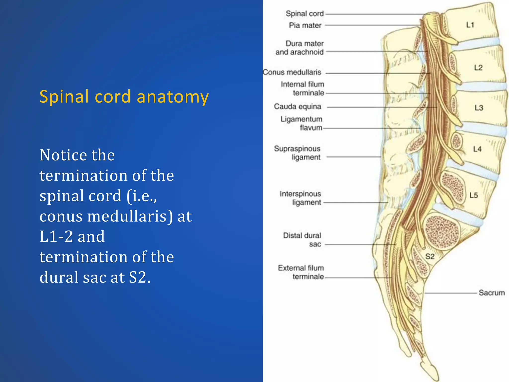 Spinal anesthesia (Anatomy and Pharmacology) | PPTX