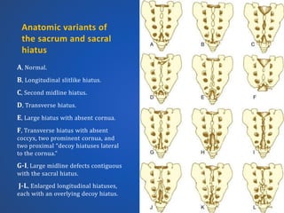 Spinal anesthesia (Anatomy and Pharmacology) | PPTX
