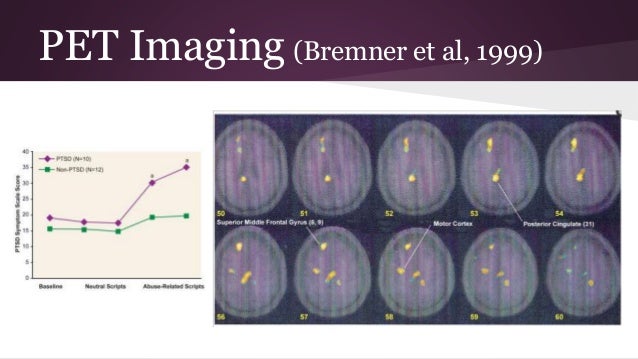 PTSD (Brain Imaging) Spring 2015