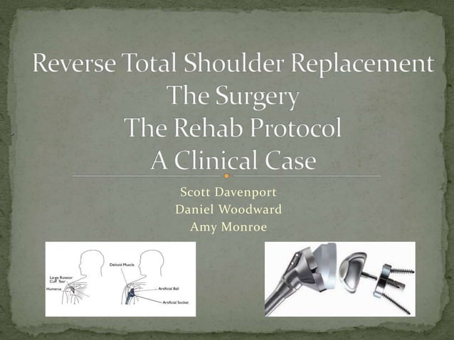 Reverse Total Shoulder Replacement, Final | PPTX | Death, Injury, or ...