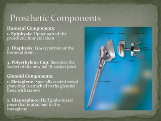 Reverse Total Shoulder Replacement, Final | PPT