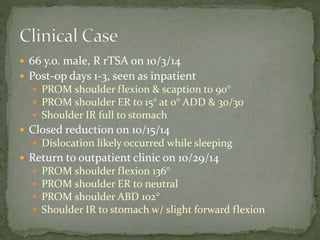 Reverse Total Shoulder Replacement, Final | PPTX