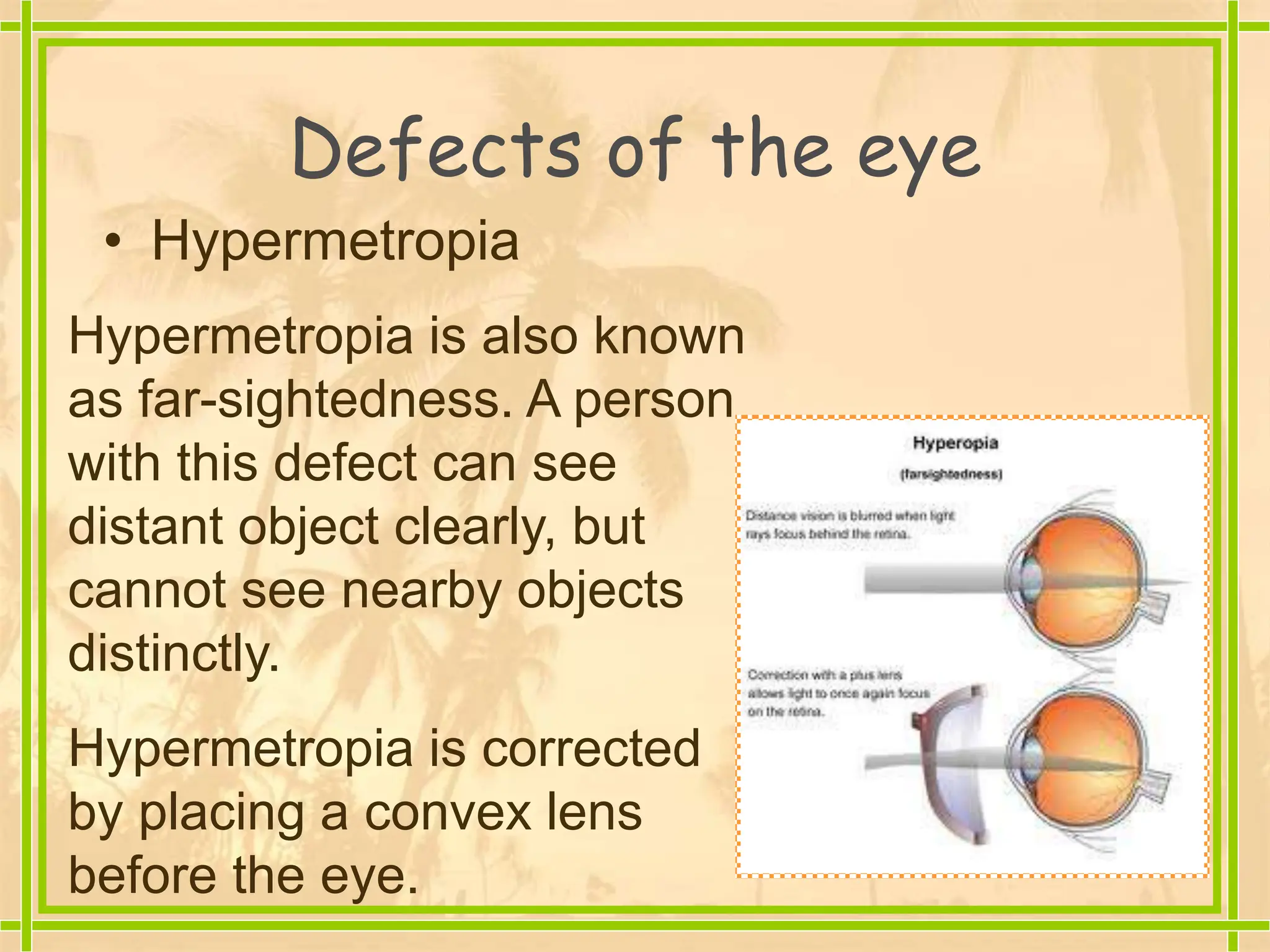 94955904-HUMAN-EYE-PRESENTATION.pptx human eye | PPT