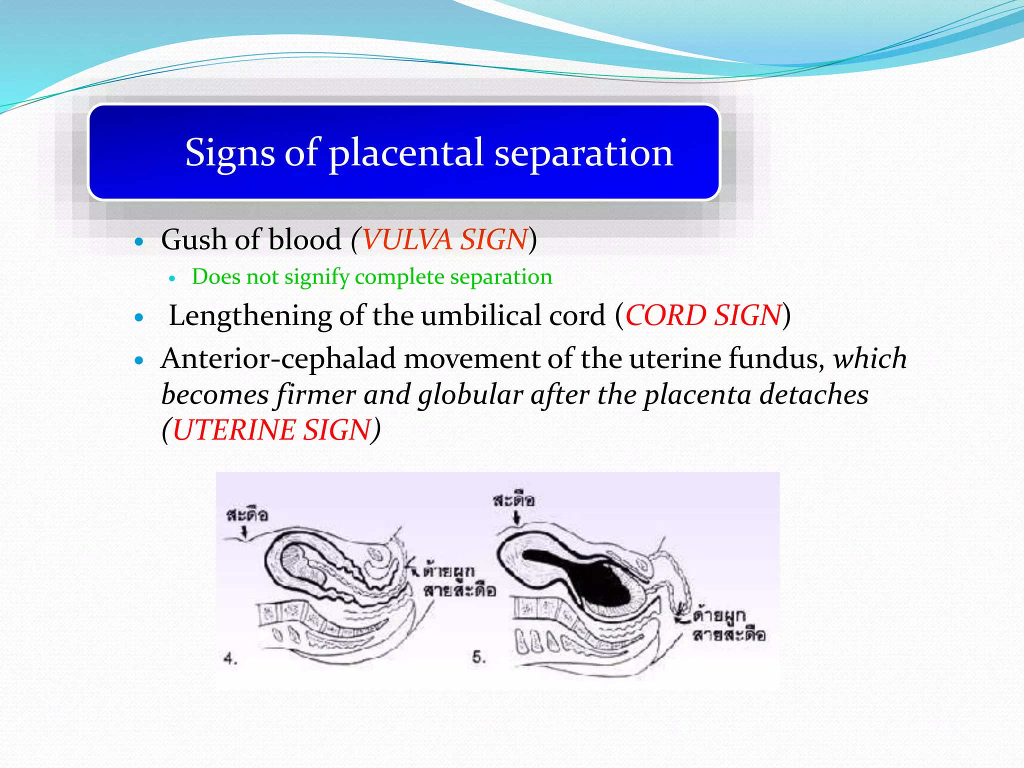 006 management of the third stage of labor | PPTX