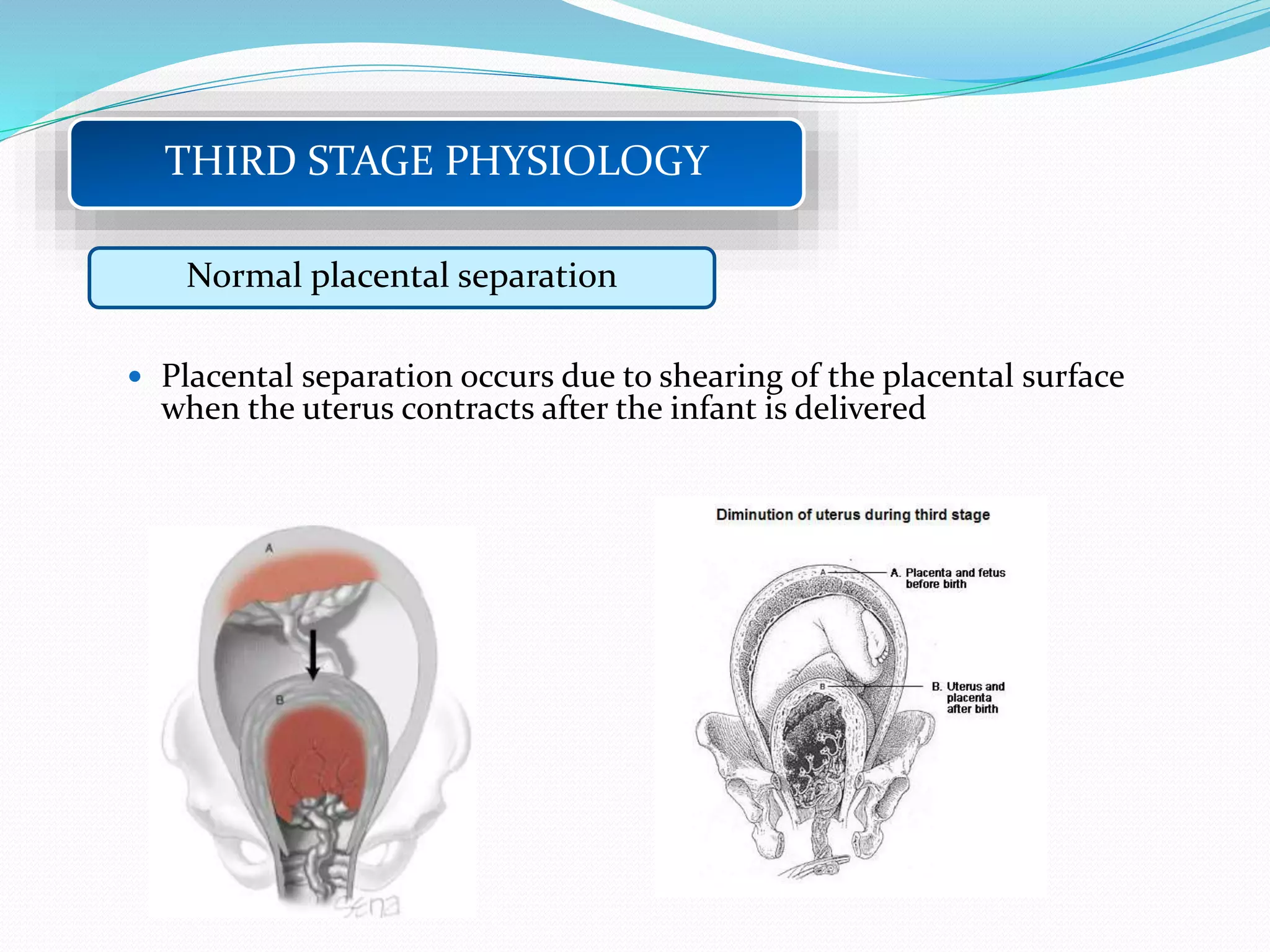 006 management of the third stage of labor | PPTX