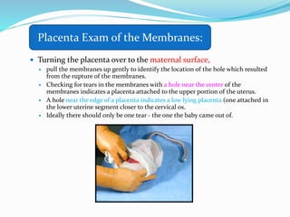 006 management of the third stage of labor | PPTX