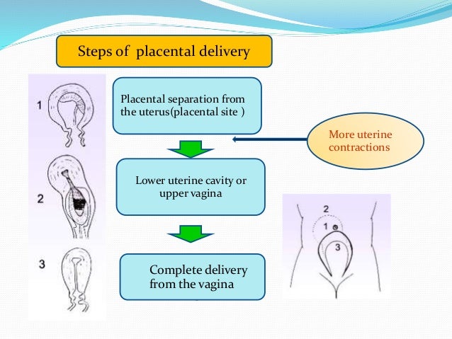 006 management of the third stage of labor