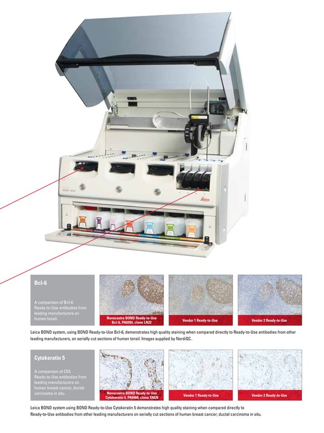 Leica BOND-MAX Instrument Brochure (95.11543 rev a_bond_max) | PDF
