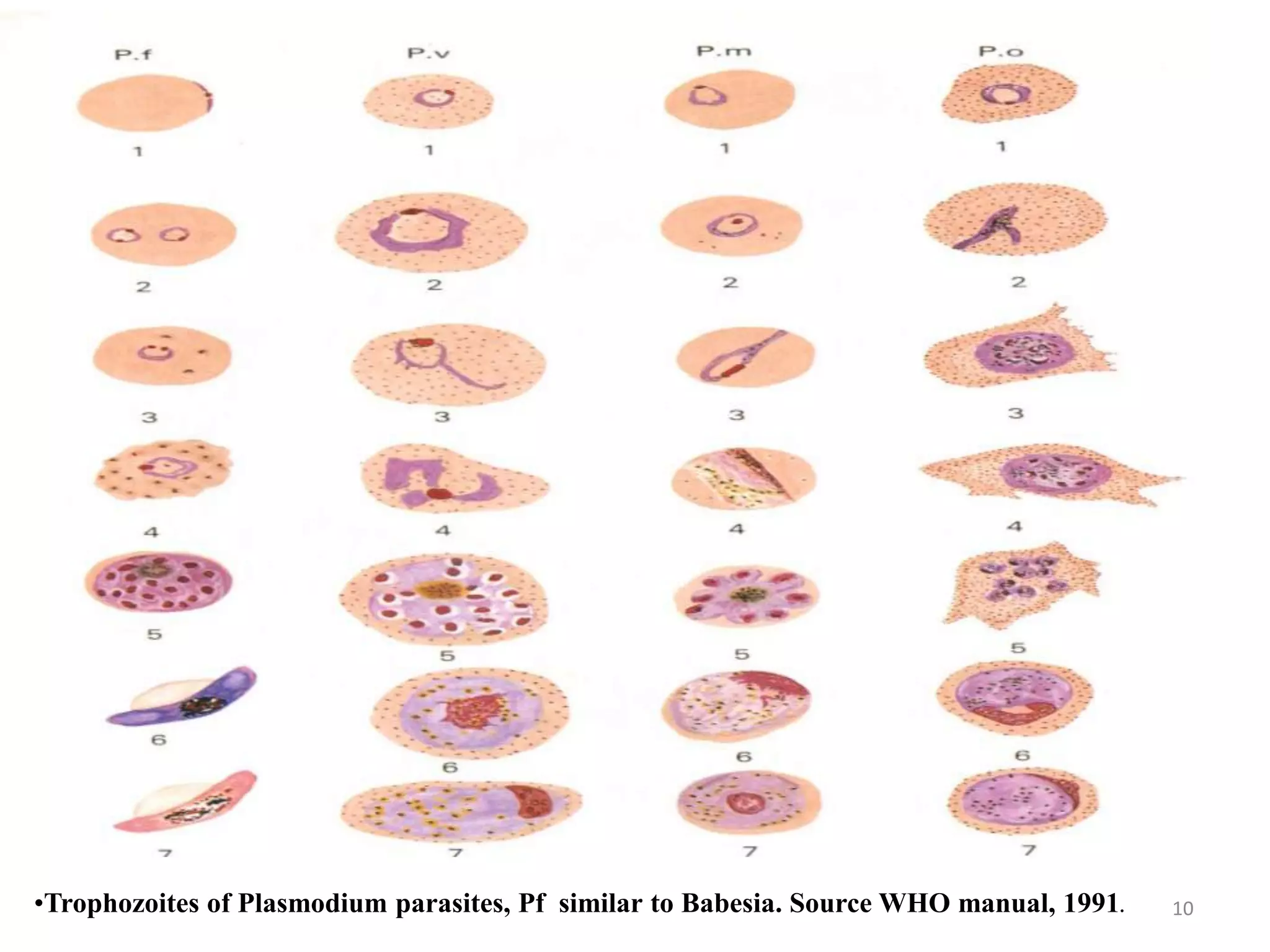 Malaria and Babesiosis co-infectionppt | PPTX