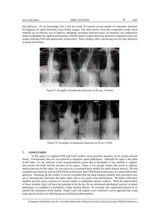 Computer aided detection for vertebral deformities diagnosis based on deep learning | PDF