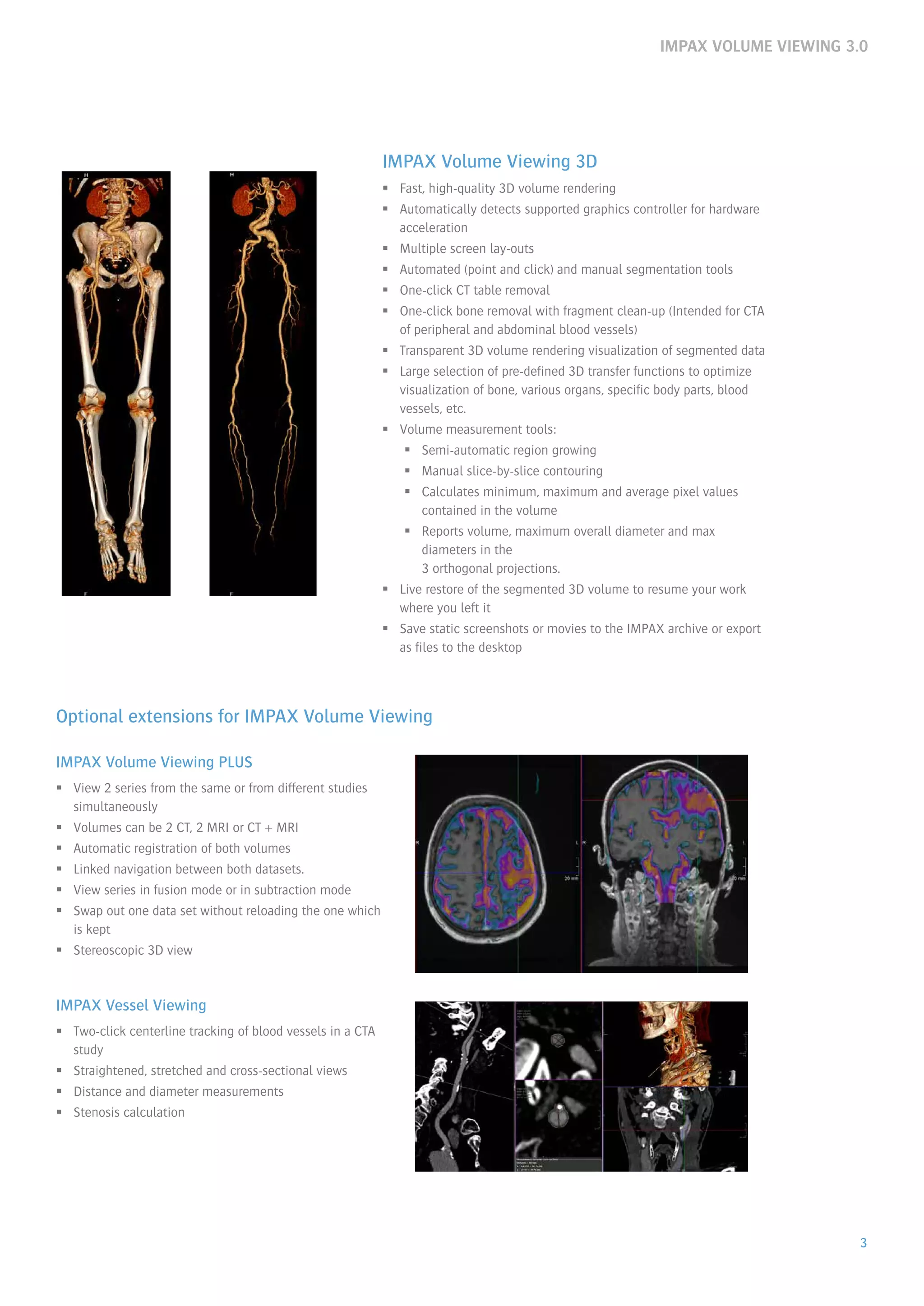 IMPAX_Volume_Viewing_(GB_-_datasheet) | PDF