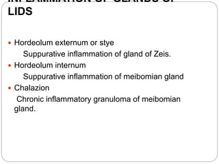 952_Lid_disorder_lecture_new.ppt | Eye and Vision Conditions | Diseases ...