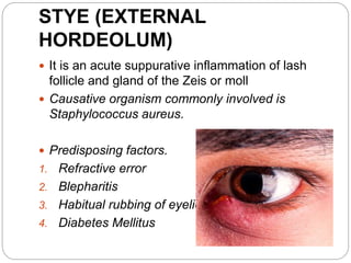 952_Lid_disorder_lecture_new.ppt | Eye and Vision Conditions | Diseases ...