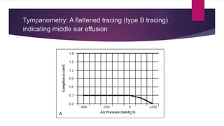 CONSERVATIVE MANAGEMENT OF OTITIS MEDIA final | PPTX