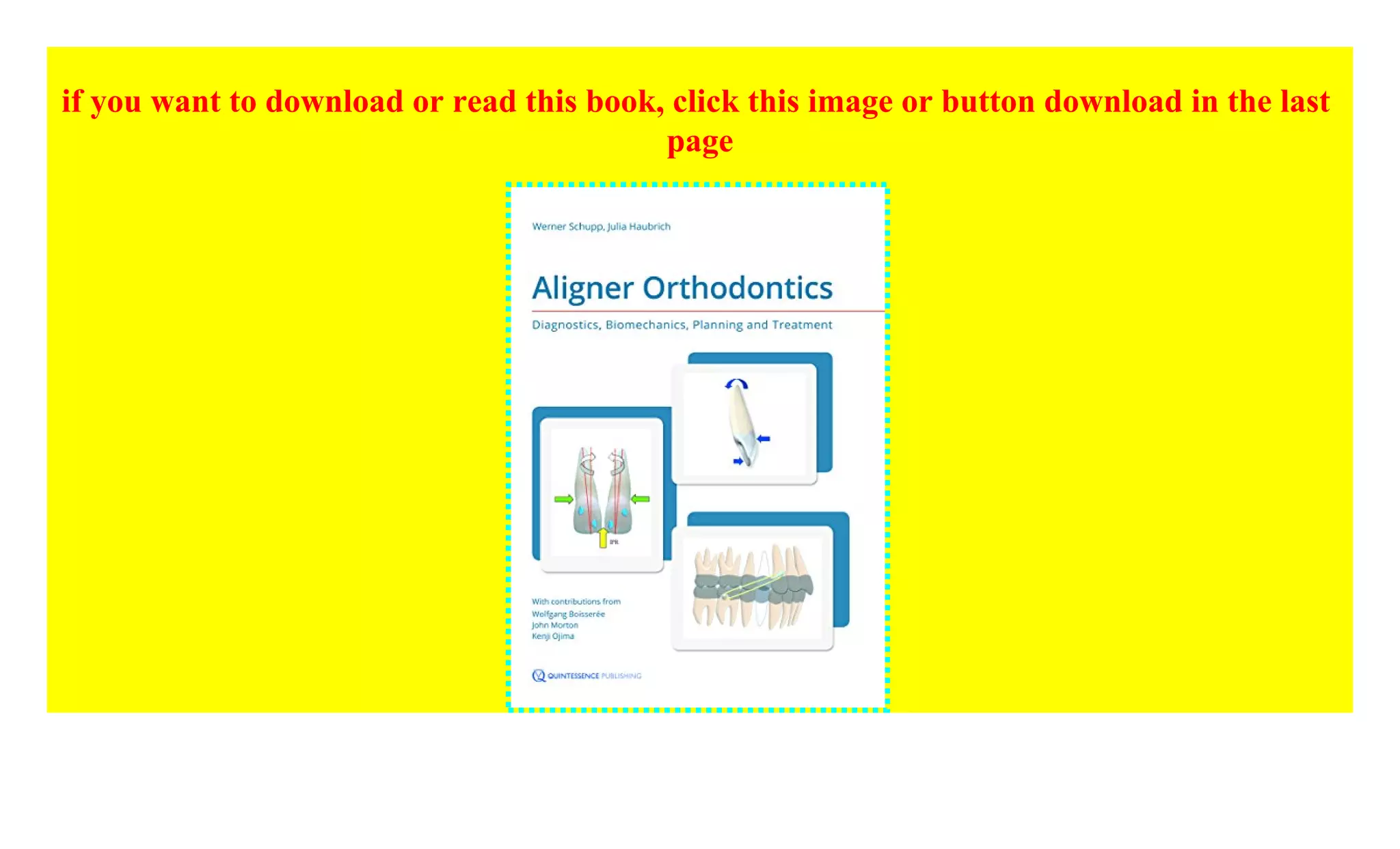 Aligner Orthodontics [P.D.F_book]@@ | PDF
