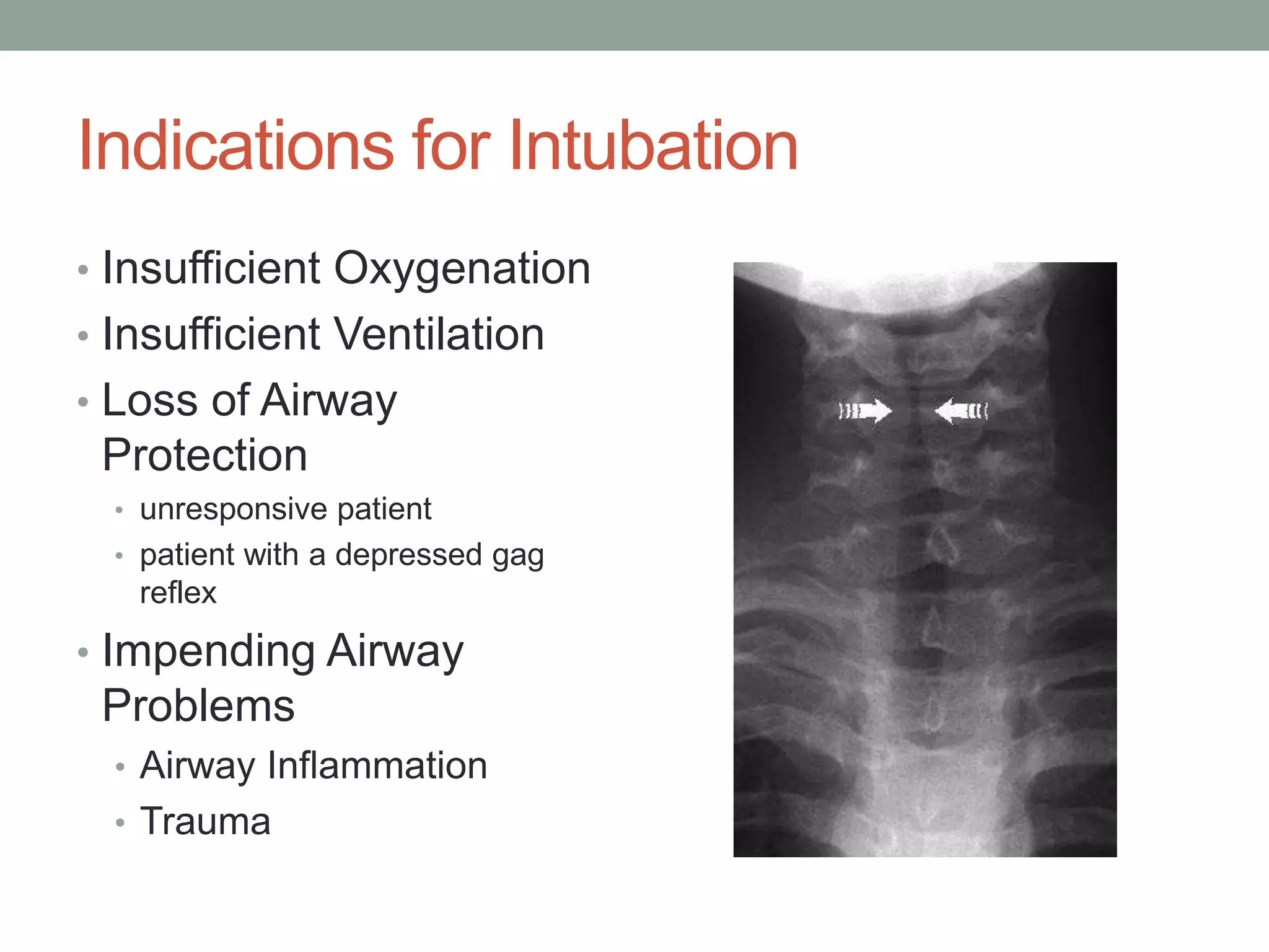 Intubation_Presentation_20150119 | PPTX | Ear, Nose and Throat ...