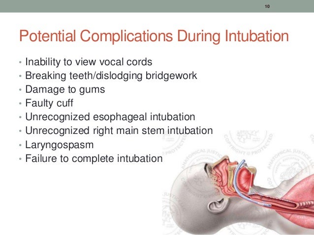 Intubation_Presentation_20150119