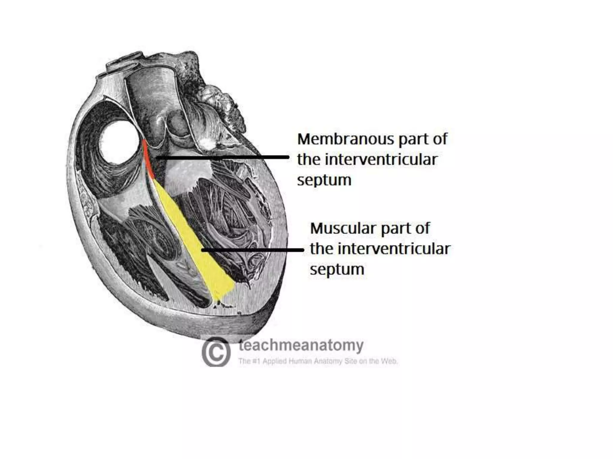 Aortic root anatomy DR NIKUNJ R SHEKHADA (MBBS,MS GEN SURG,DNB CTS SR ...